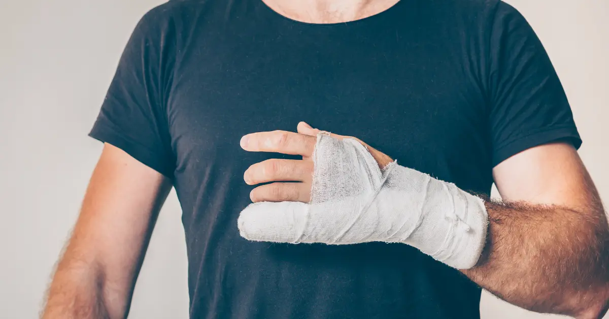 Hand Fractures - Life Physiotherapy Clinic