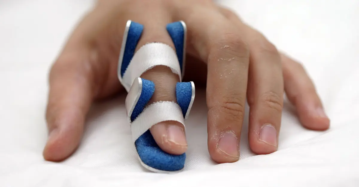 Mallet Finger - Life Physiotherapy Clinic