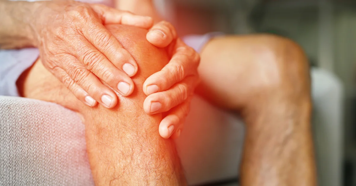 Pes Anserine Bursitis - Life Physiotherapy Clinic