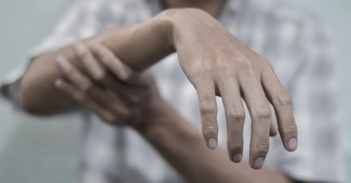 Radial Nerve Injury - Life Physiotherapy Clinic Radial Nerve Injury - Life Physiotherapy Clinic