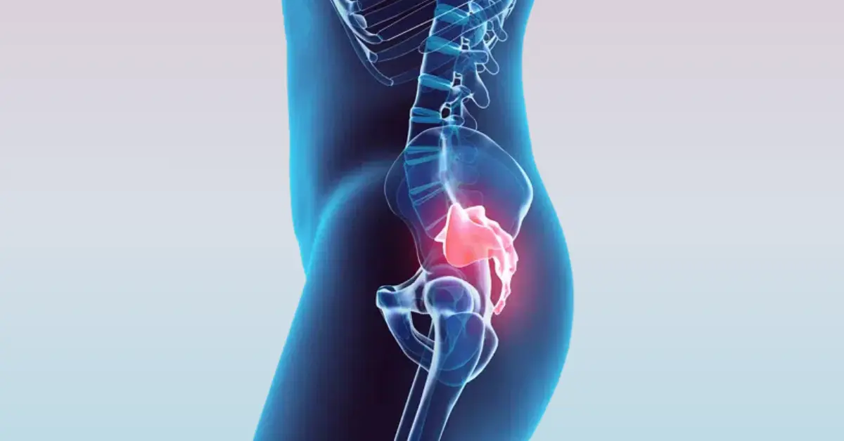 Tailbone Pain/ Coccydynia - Life Physiotherapy Clinic