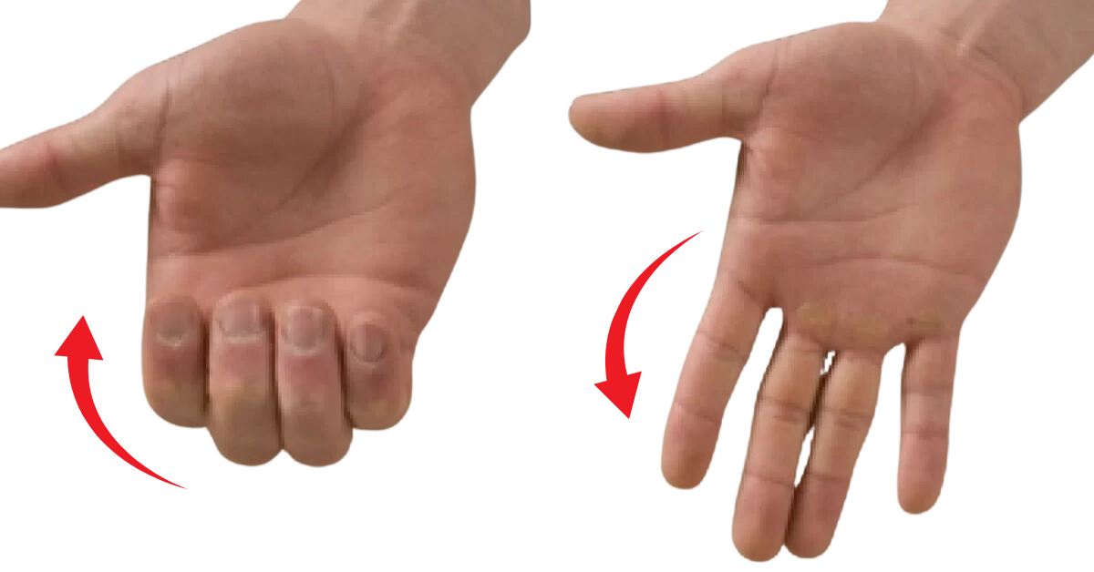 What is Finger Physiotherapy? | Benefits & Exercises Explained